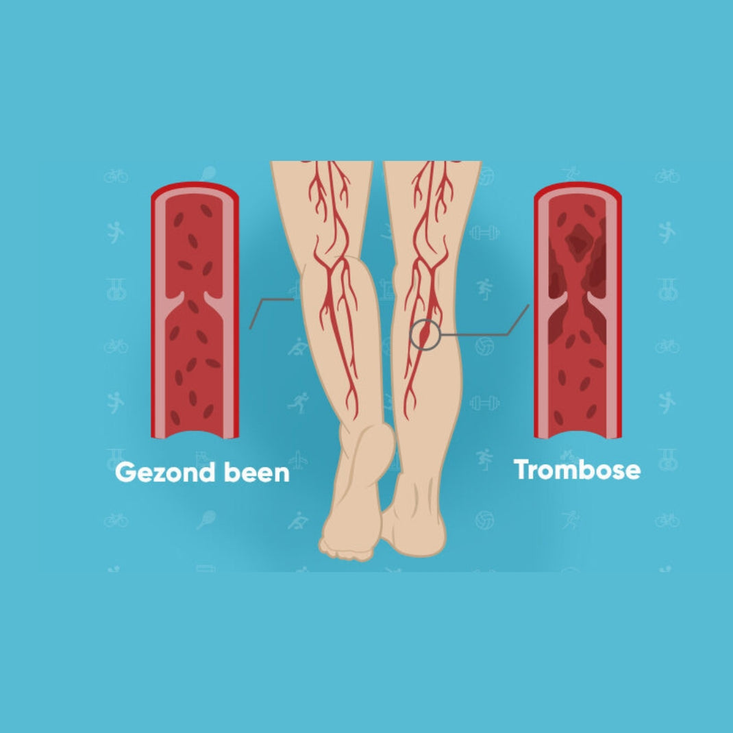 Trombose: wat is het en hoe kun je het risico verkleinen? | Herzog Medical